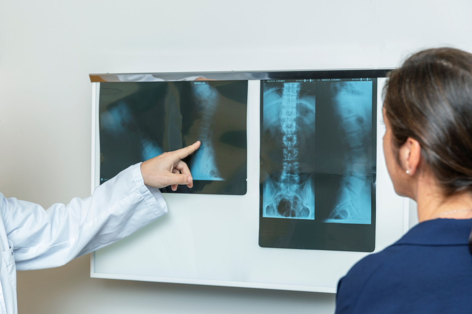 Recovery after lumbar arthrodesis surgery